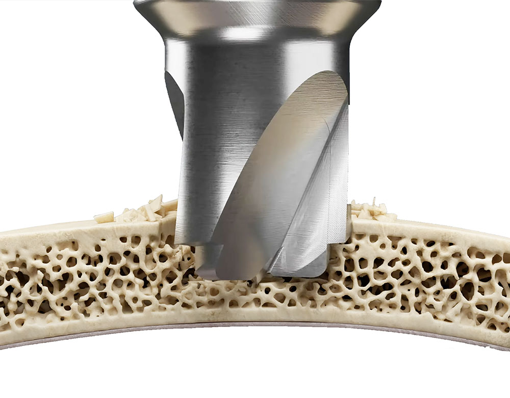 Cranial Perforator – Vitalys Surgical (France) – MJ Gold Pharma